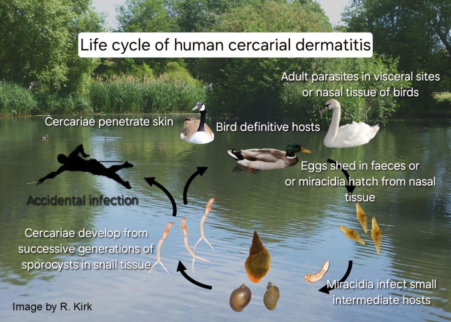 Swimmers Itch Life Cycle Swimmer's Itch North Bay Parry Sound