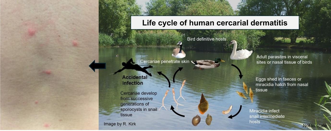 Help map human cercarial dermatitis (swimmer's itch) in the UK ...